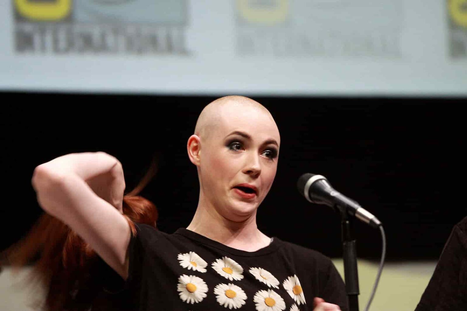 21 Bald Female Celebrities: From Jada Smith To Joey King