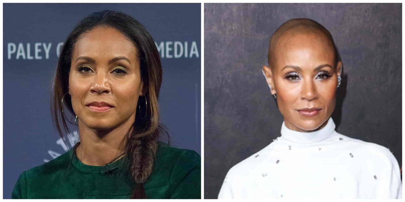 21 Bald Female Celebrities: From Jada Smith To Joey King