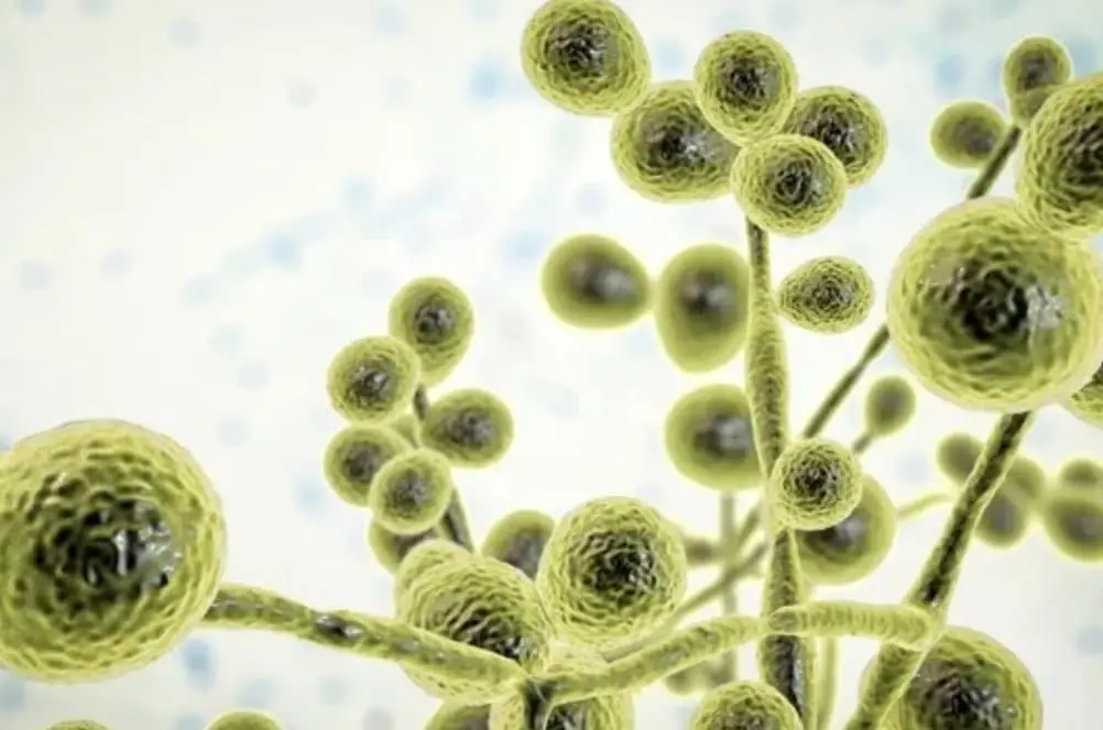 Fungal Infection In Hair: How It Looks & Treatment