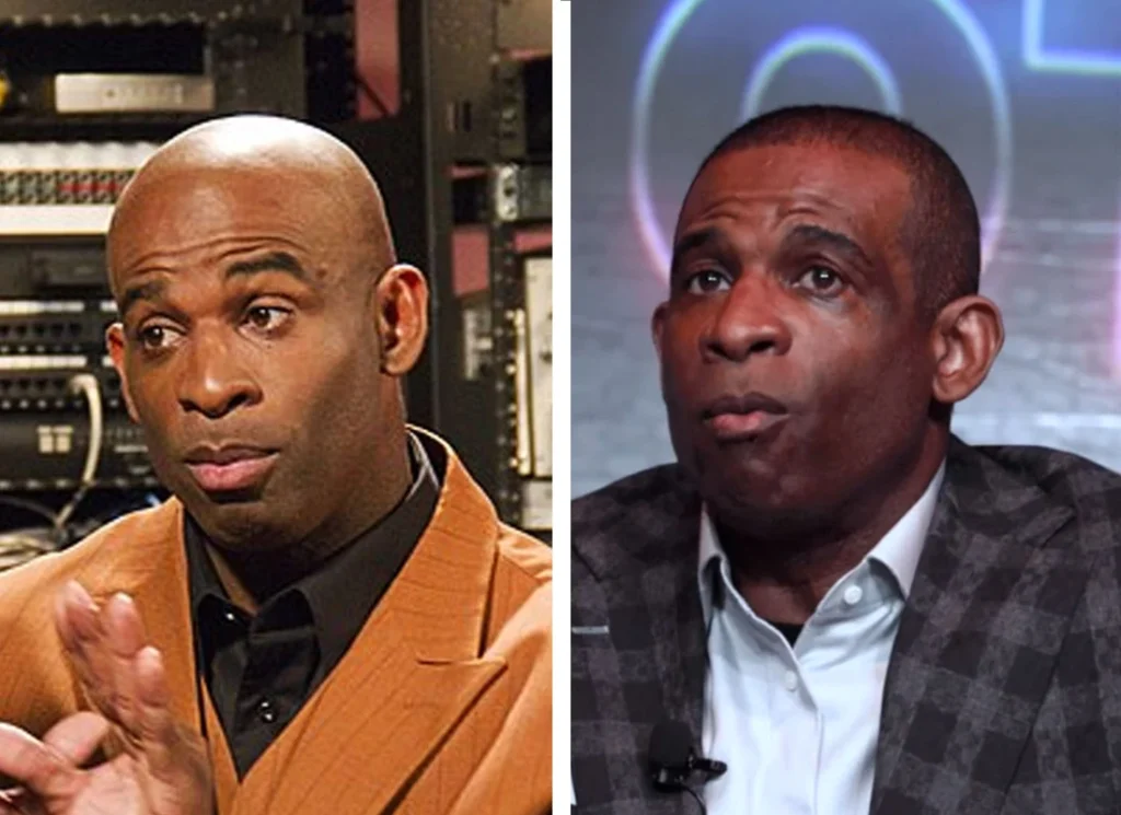 Deion Sanders Hair Transplant: A Complete Analysis
