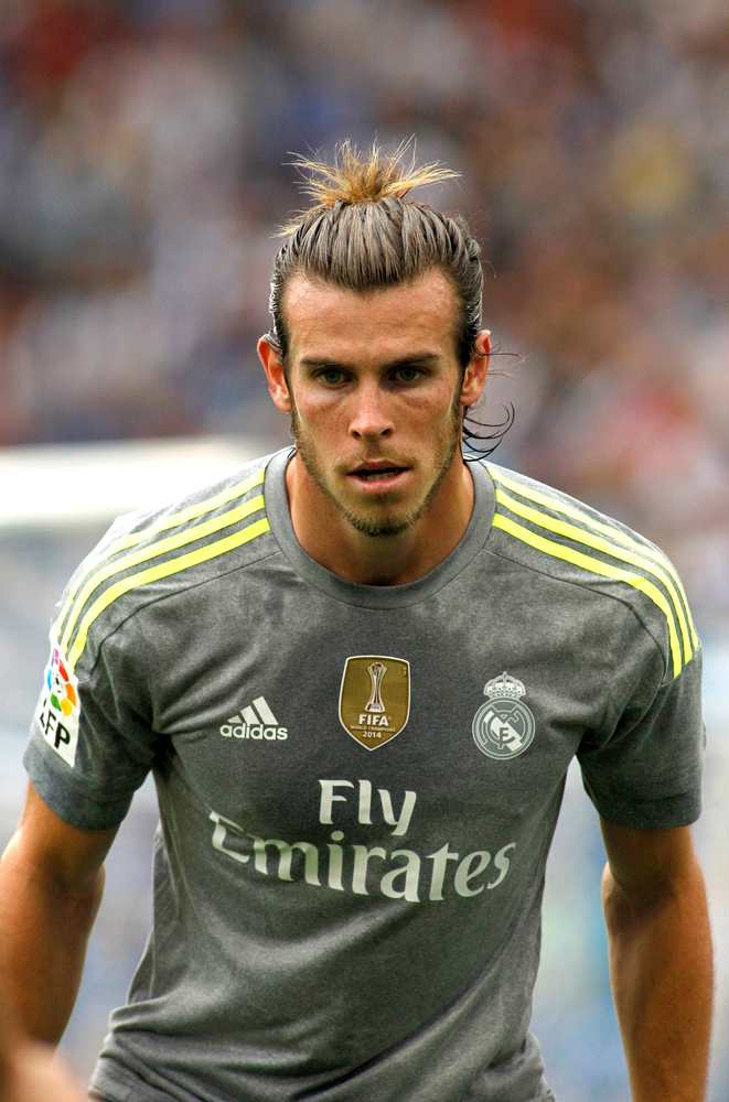Gareth Bale's Hair Transplant | Longevita