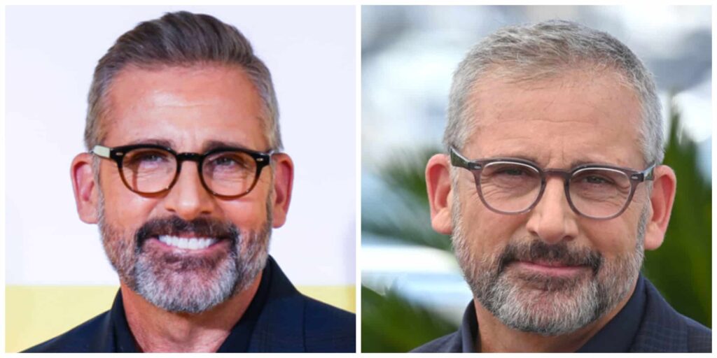 World's Best Hair: Steve Carell Hair Transplant | Longevita