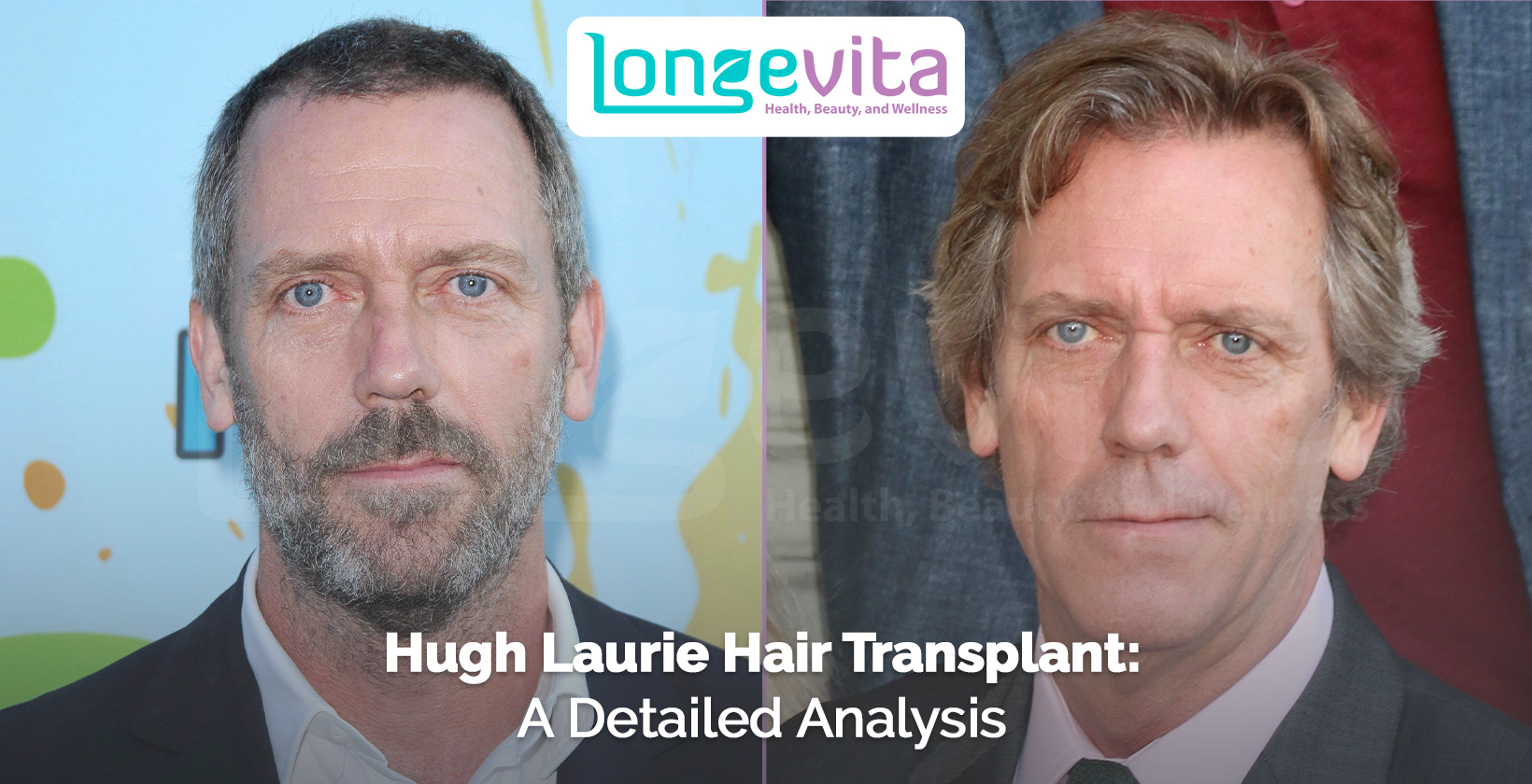 Hugh Laurie Calvo A Different Hugh As House Star Laurie Shows Signs Of