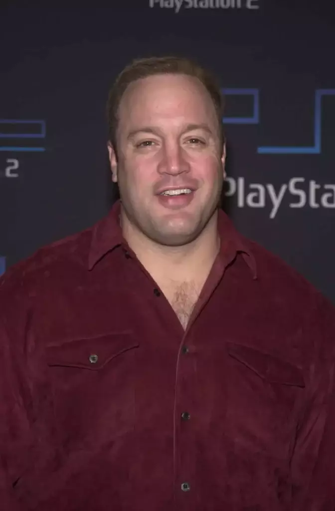 Kevin James' Hair Transplant | Longevita