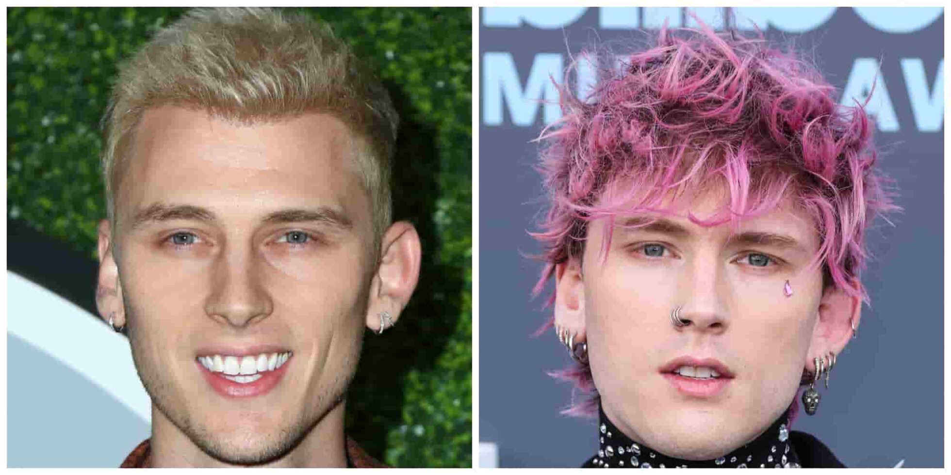 Machine Gun Kelly - MGK Hair Transplant: Did It Happen?